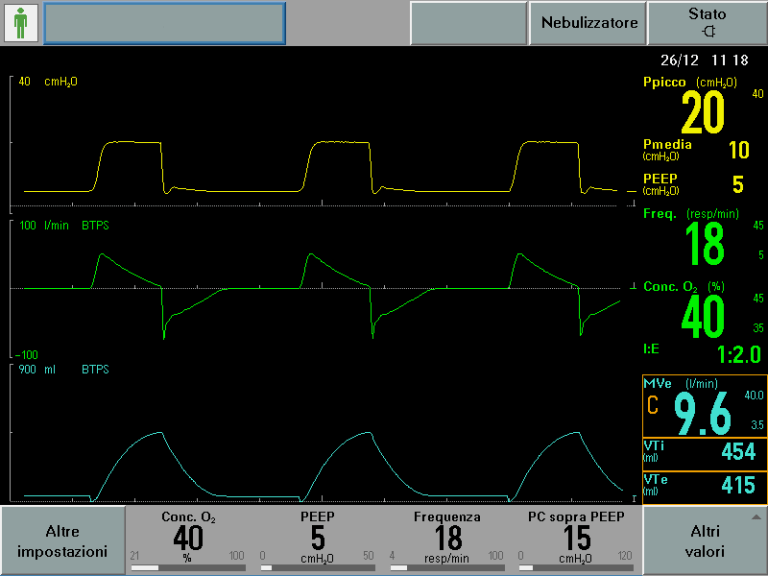 Pressure Controlled Ventilation (PCV) | Triggerlab