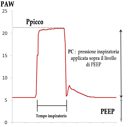 Pressure Controlled Ventilation (PCV) | Triggerlab