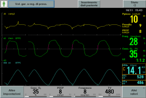 Modalità di ventilazione meccanica: Pressure Controlled ventilation-volume guaranteed (PCV-VG ...