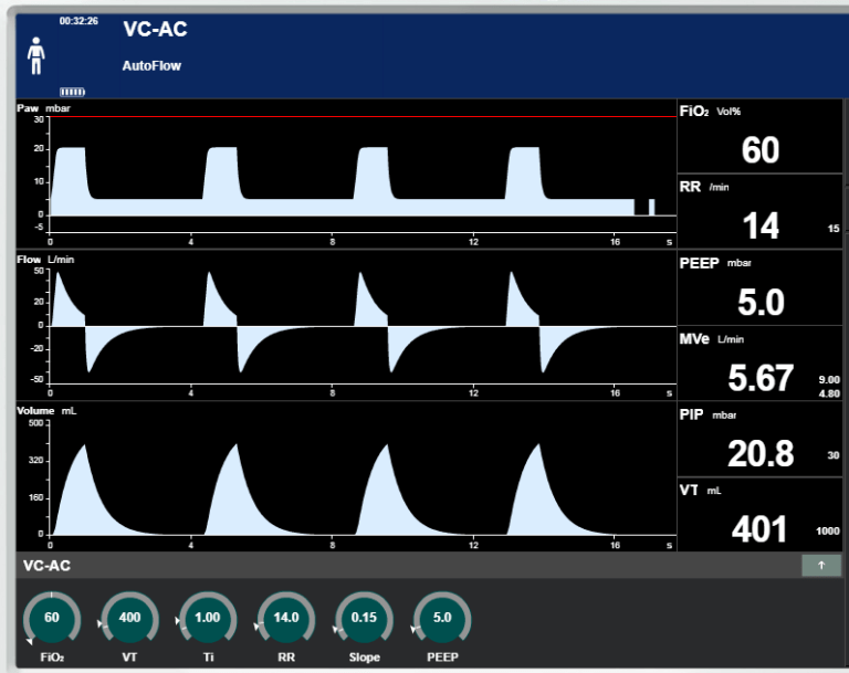 Modalità di ventilazione meccanica: Pressure Controlled ventilation-volume guaranteed (PCV-VG ...