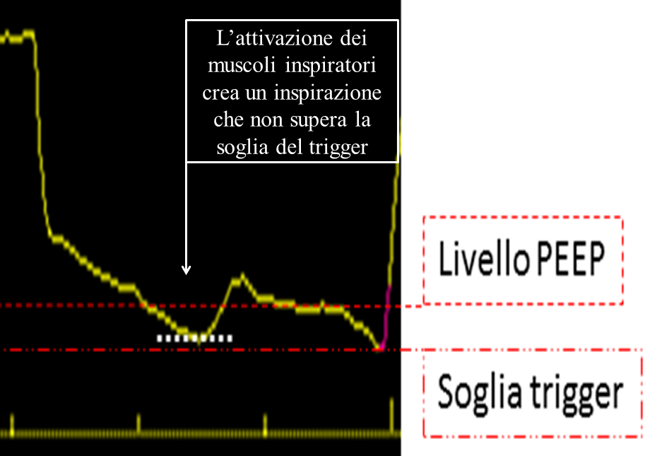 Sforzo inefficace (Ineffective effort) | Triggerlab