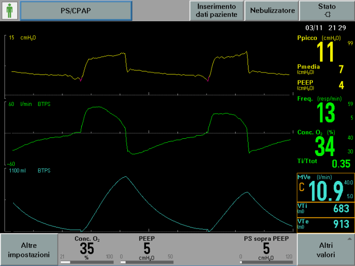 Pressure Support Ventilation (PSV) | Triggerlab