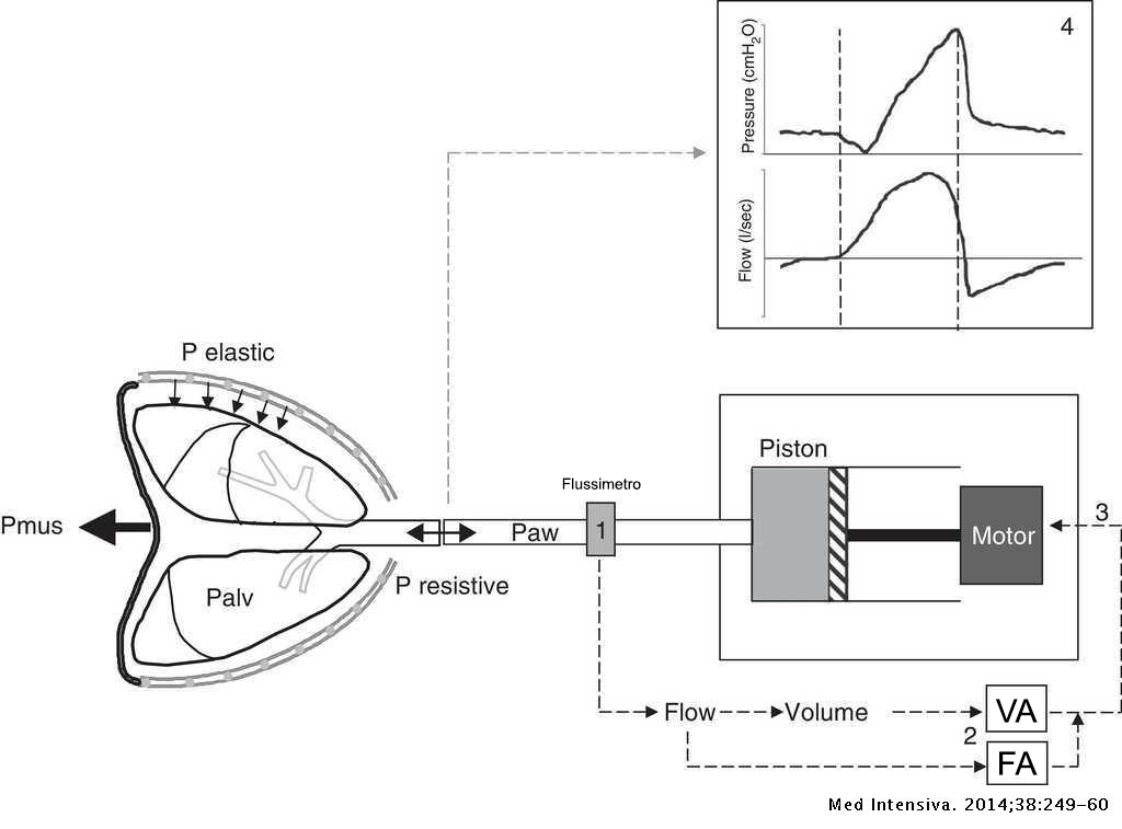 Proportional Assist Ventilation | Triggerlab