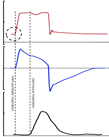 Reverse Triggering | Triggerlab