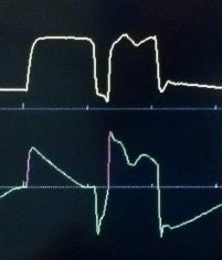 Reverse Triggering | Triggerlab