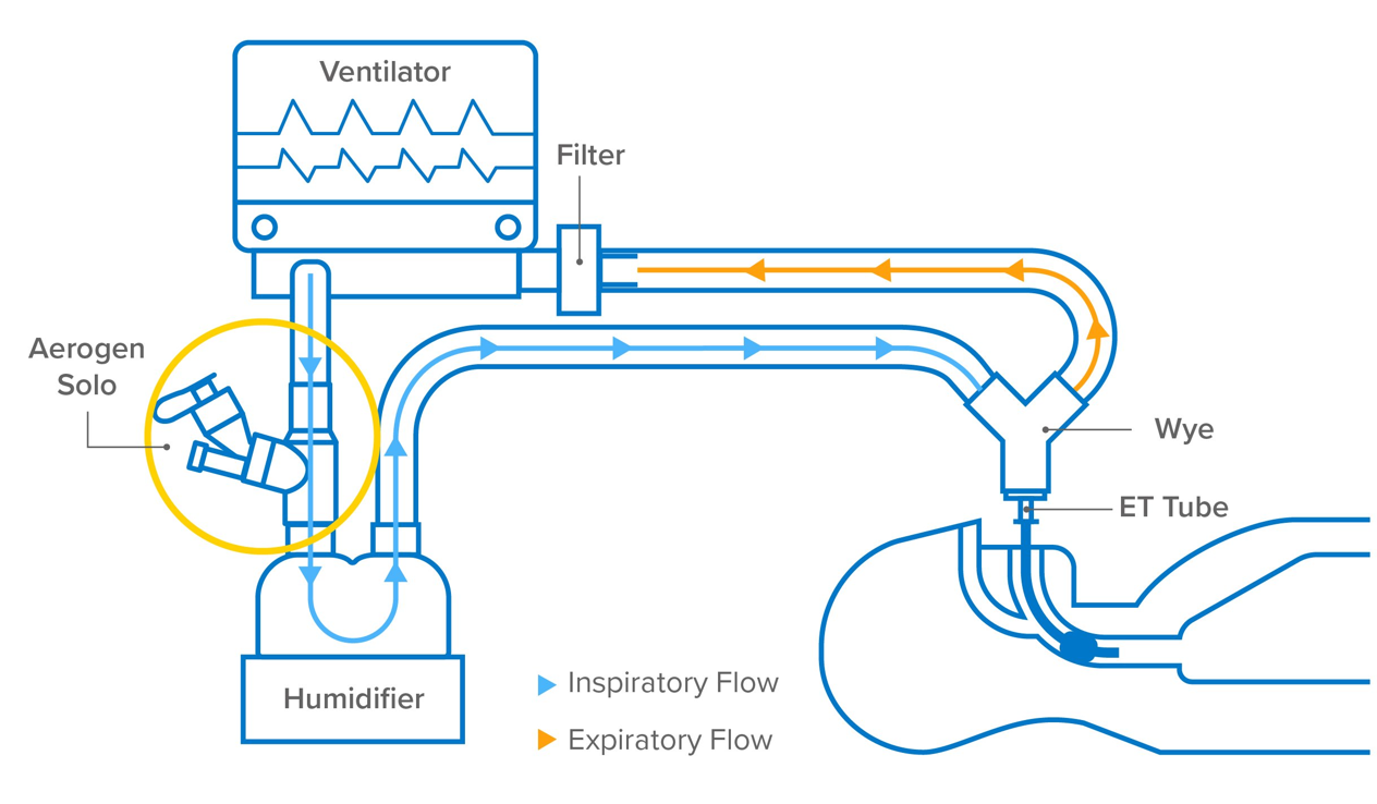 Aerosol terapia durante ventilazione meccanica. Parte 2 | Triggerlab