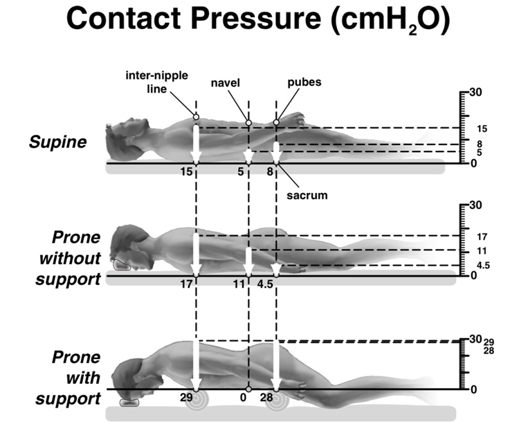 PRONE POSITIONING: From basic concepts to practice | Triggerlab