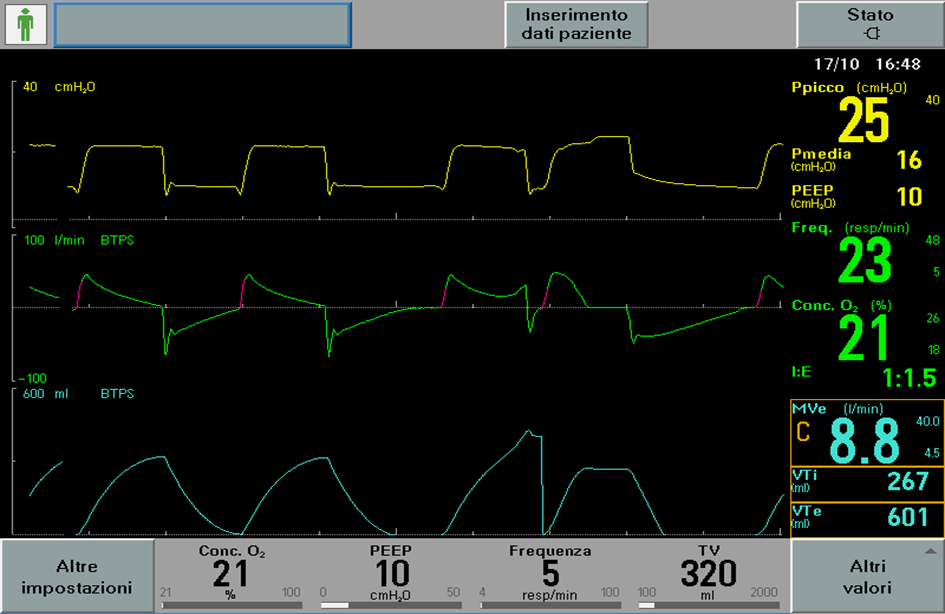 Patient Self-Inflicted Lung Injury (P-SILI) part 1 | Triggerlab